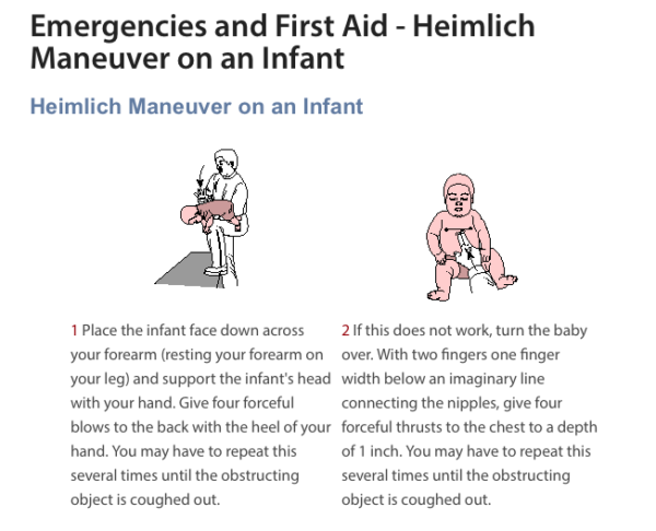 Baby Heimlich – STEM Starts Now